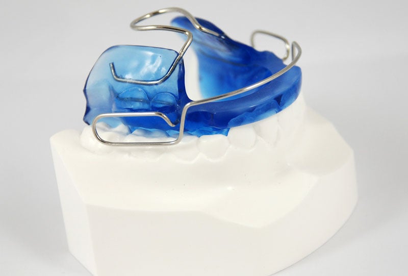 Bionator: 혀 근육 균형 조정 치아교정 장치 : 네이버 블로그