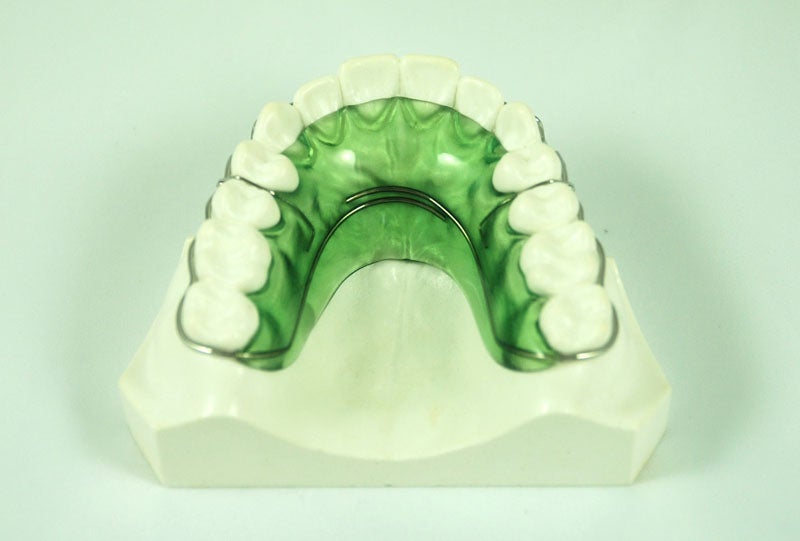 Hawley Retainer, Wrap-around Retainer: 치아교정 유지장치 : 네이버 블로그