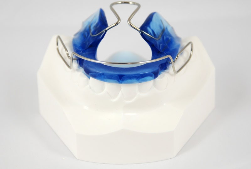 Bionator: 혀 근육 균형 조정 치아교정 장치 : 네이버 블로그