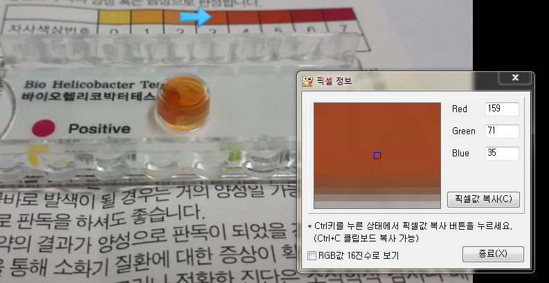 CLO (campylobacter-like organism test) 에서 육안적으로 약한 양성 결과로 생각; 양적 평가 ...