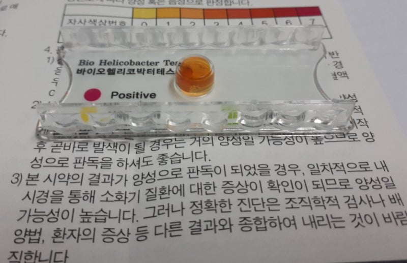 CLO (campylobacter-like organism test) 에서 육안적으로 약한 양성 결과로 생각; 양적 평가 ...