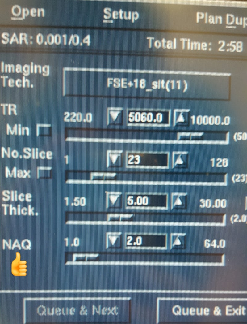 MRI의 NEX와 Band width : 네이버 블로그