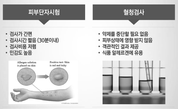 알레르기 진단방법(3) : 혈정학적 검사 (MAST, RAST, ImmunoCAP이뮤노캡/UniCAP유니캡) : 네이버 블로그
