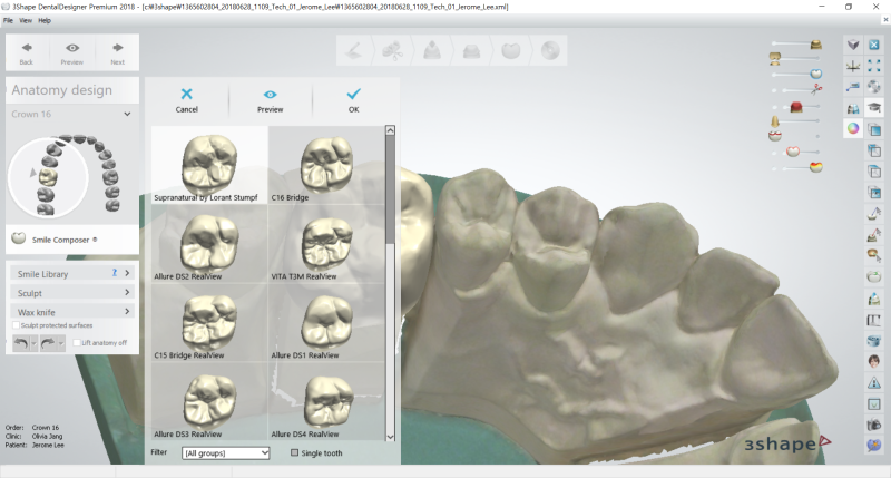 [3Shape Dental System] 2-2. 입문편 Single Crown 디자인 : 네이버 블로그