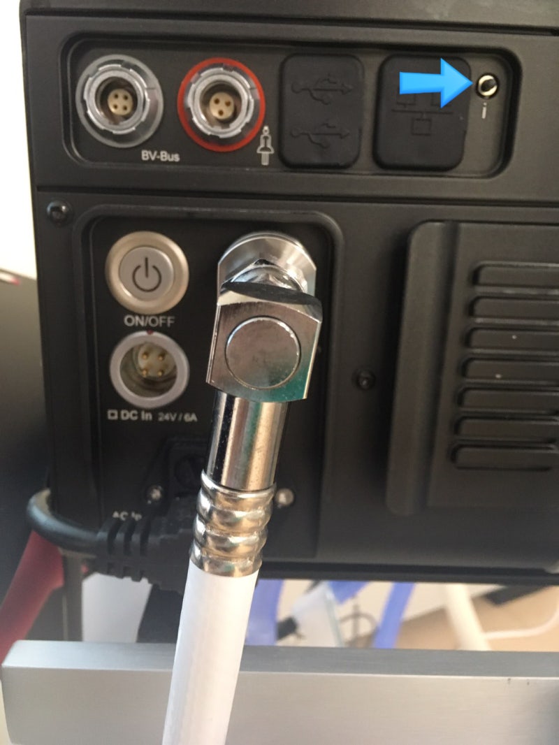 Ventilator, 인공호흡기, Bellavista에 대해서. : 네이버 블로그