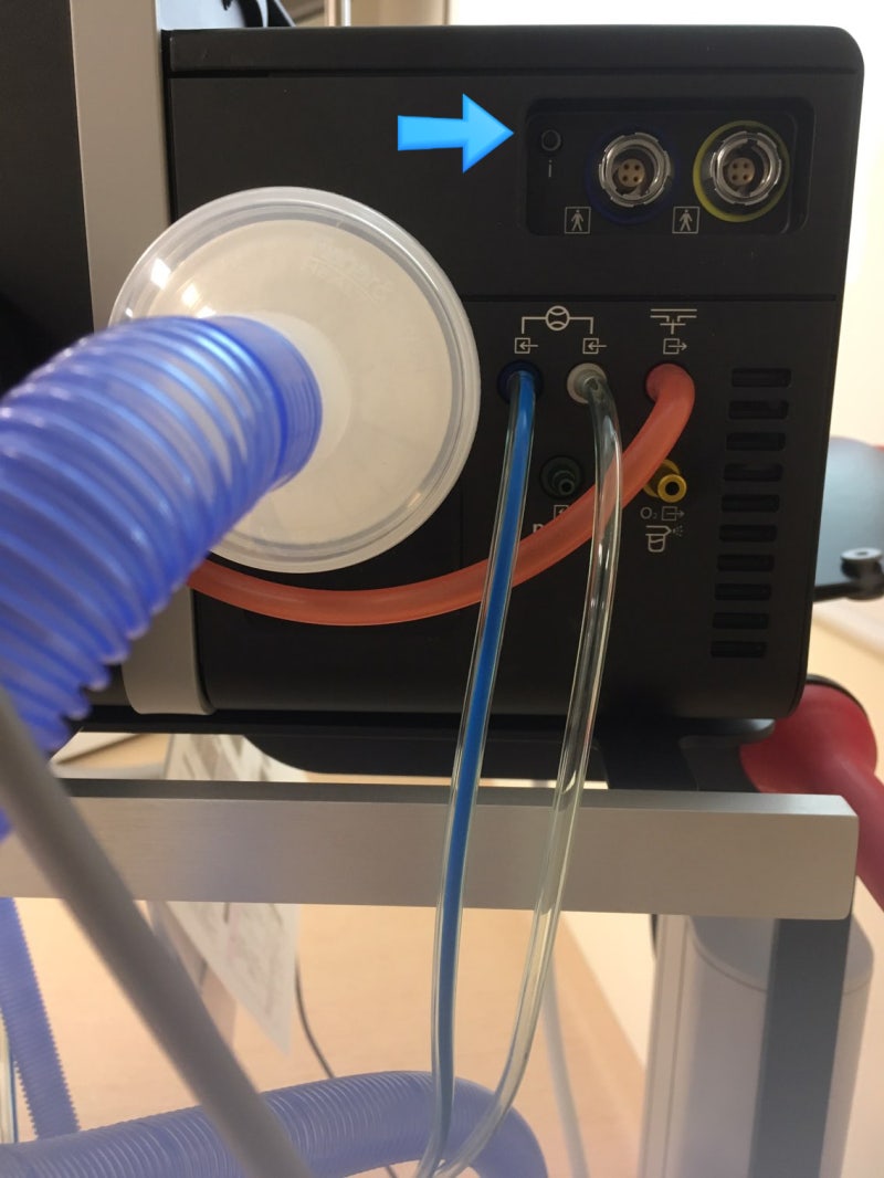 Ventilator, 인공호흡기, Bellavista에 대해서. : 네이버 블로그