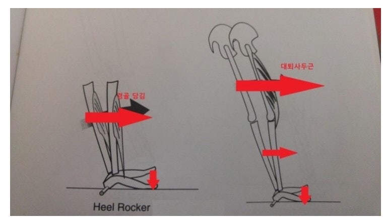 보행시 3가지 rocker (발구름) 알아보기 : 네이버 블로그