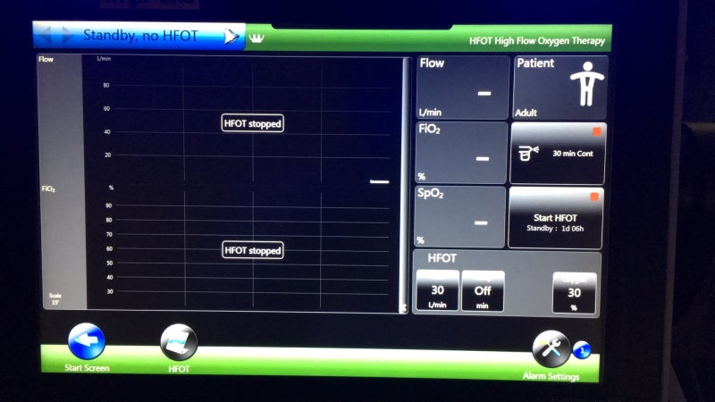 Ventilator, 인공호흡기, Bellavista에 대해서. : 네이버 블로그