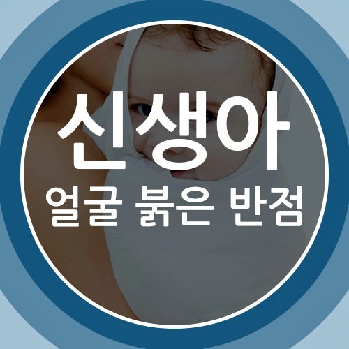 신생아 얼굴 붉은 반점 연어반 왜생기는건가요 네이버 블로그