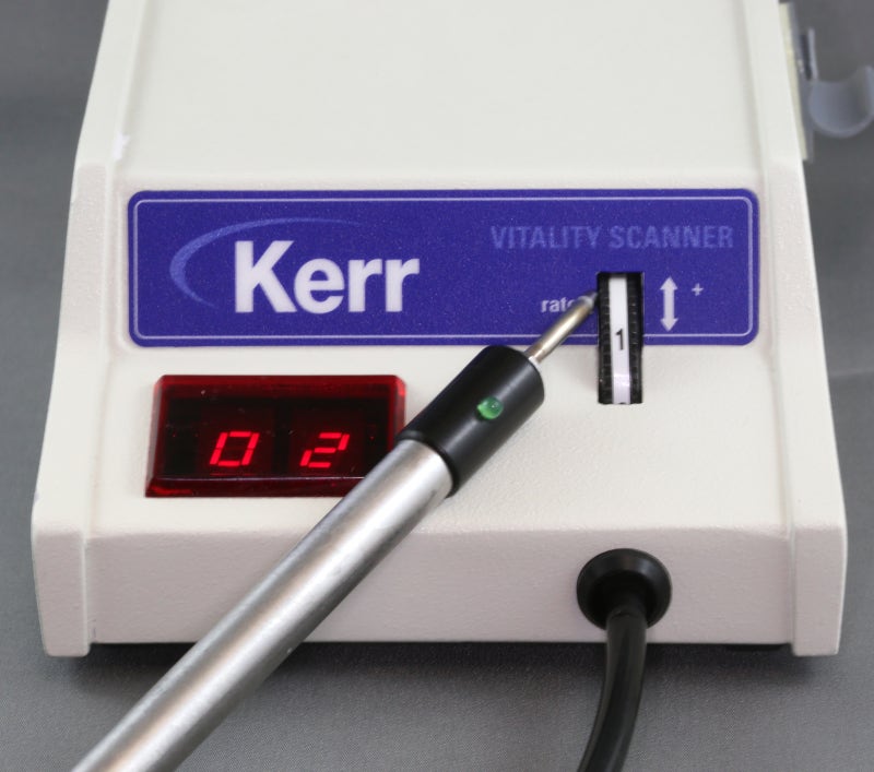 치아 치수생활력 검사 ( 치아신경 반응검사 ) 방법들 :: 치수괴사 진단 :: 신경이 살아있어요 ! 죽어있어요 ! by 닥터 ...