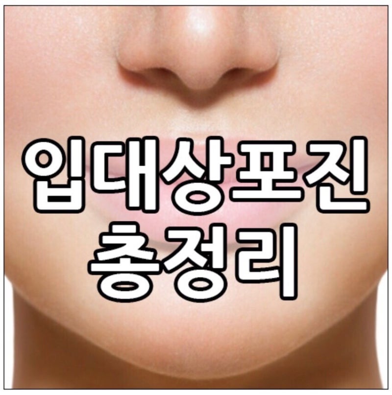 입안 대상포진 입대상포진 입술물집 헤르페스 증상 치료방법 네이버 블로그