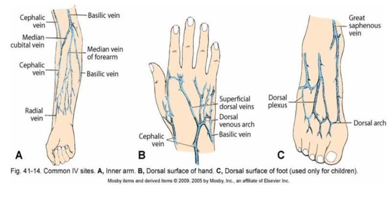 Intravenous Therapy 정맥요법 : 네이버 블로그