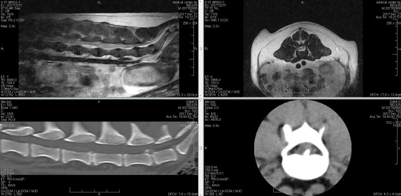 대전동물병원 [24시 대전동물메디컬센터 숲] 외과 CASE ; 강아지 IVDD / 추간판탈출증(Inter Vertebral ...