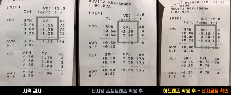 하드렌즈 꿀팁 알려드려요 네이버 블로그