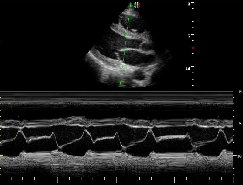 소노스케이프 S8EXP 초음파 (주)유티비 : 네이버 블로그