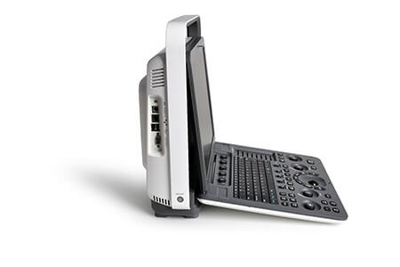 소노스케이프 S8EXP 초음파 (주)유티비 : 네이버 블로그