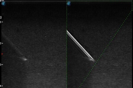 소노스케이프 S8EXP 초음파 (주)유티비 : 네이버 블로그