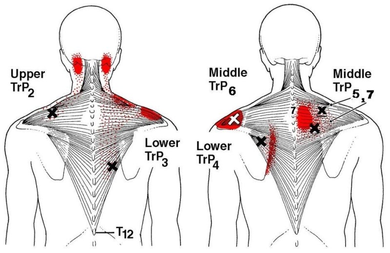 [위 몸통] 승모근(Trapezius, 僧帽筋) : 네이버 블로그