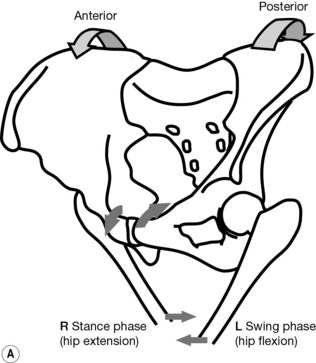 만성골반통증 환자와 골반뒤틀림(Pelvic distortion)과의 관계 : 네이버 블로그