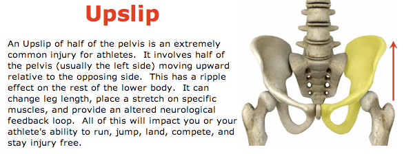 만성골반통증 환자와 골반뒤틀림(Pelvic distortion)과의 관계 : 네이버 블로그