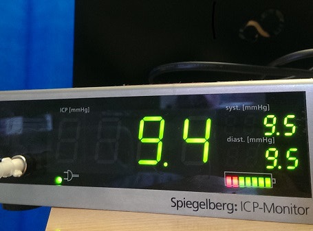 Intracranial Pressure(ICP) Monitoring, 두개내압 감시 및 측정 : 네이버 블로그