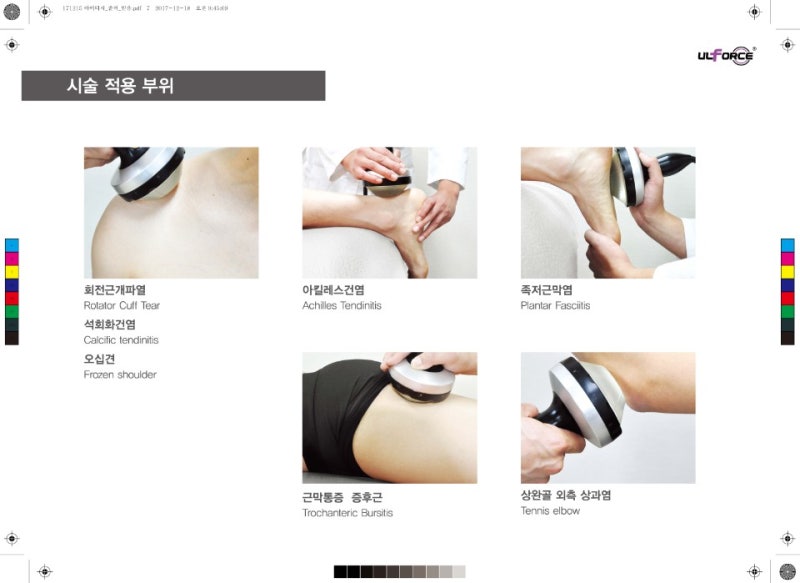 ULforce체외충격파(ESWT) : 네이버 블로그