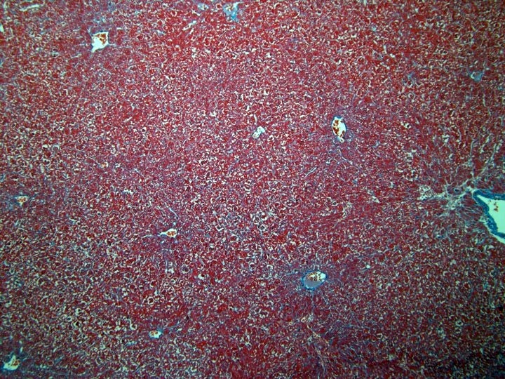 Masson's Trichrome stain : 네이버 블로그