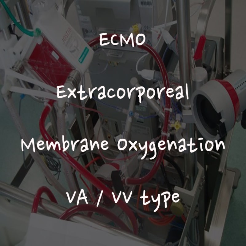 ECMO(에크모) 치료,간호 및 환자관리. Extracorporeal Membrane Oxygenation(VA,VV type ...