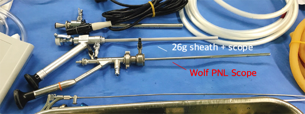 ECIRS (PCNL+RIRS) 경피적 신쇄석술 수술과정 : 네이버 블로그