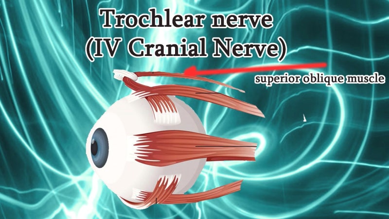 fourth[trochlear] nerve palsy : 네이버 블로그