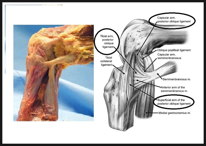무릎 내측 인대 -MCL/POL (Posterior Oblique Ligament) : 네이버 블로그