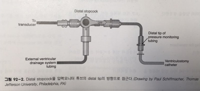 EVD[External Ventricular Drainage] : 뇌실 외 배액. 간호. : 네이버 블로그