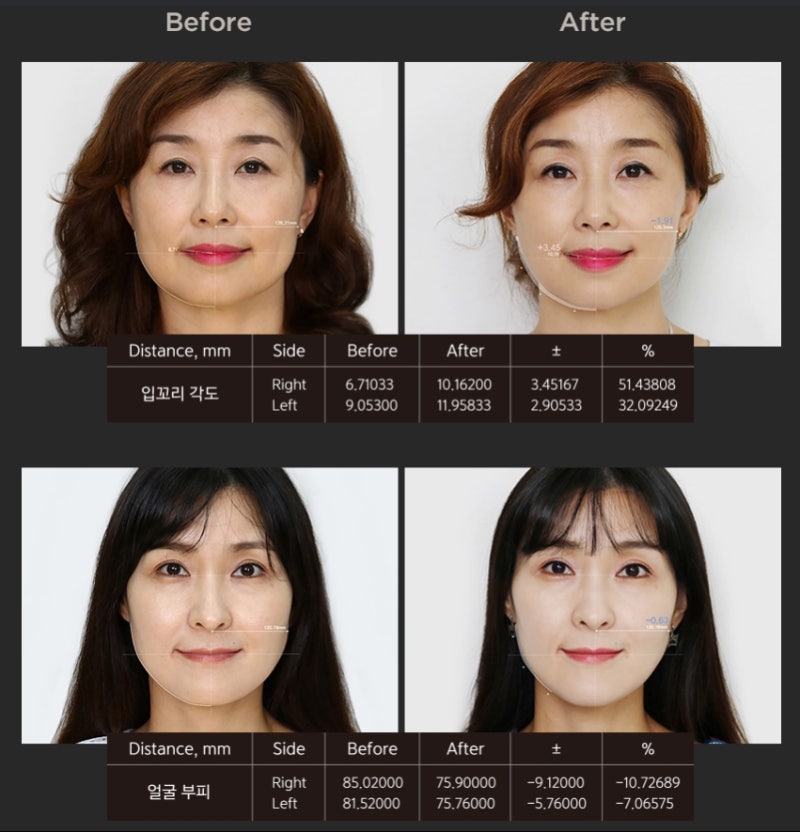 팔자주름 없는 작은얼굴 만들기~ 파오(PAO) 30초 얼굴근육 운동ㅋ : 네이버 블로그