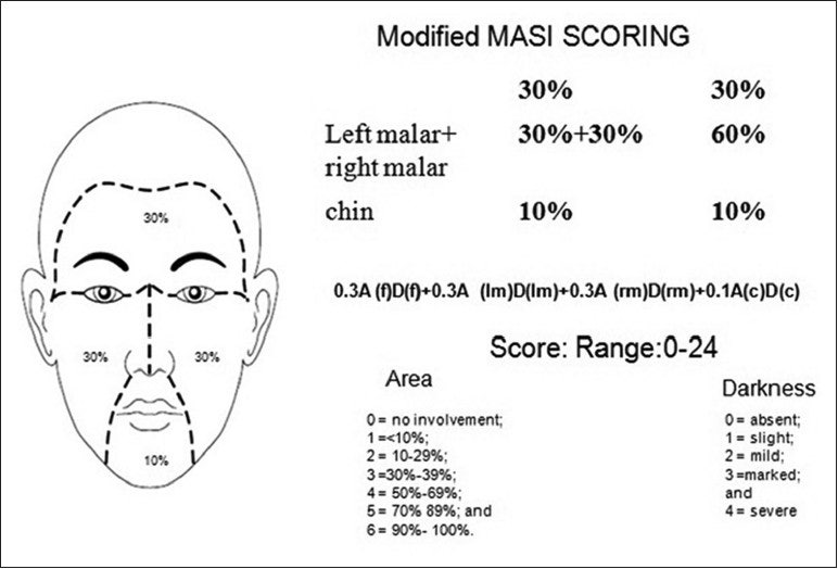[ 색소 치료 ] 제 기미가 얼마나 심한 거죠? - 석촌동, 송파동, 가락동 헬리오시티피부과 : 네이버 블로그