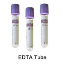 혈액검사 Bottle. [채혈검사, 혈액검사, 피검사, EDTA, CBC Bottle, Tubes] : 네이버 블로그