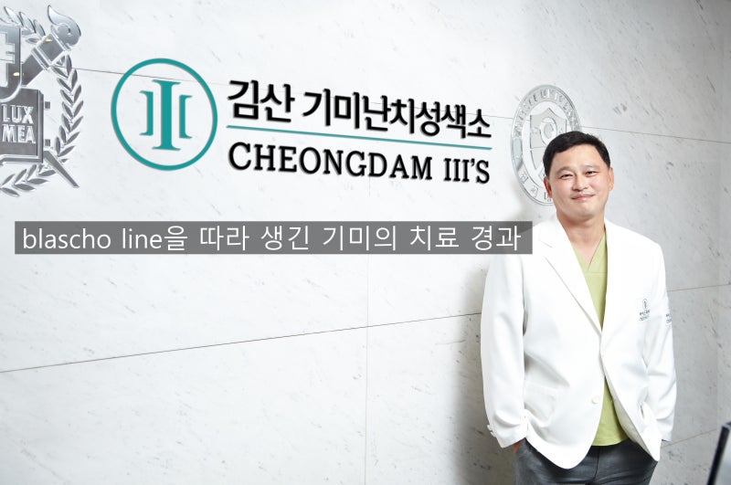 blaschko line을 따라 생긴 unusal 한 기미의 치료 경과 : 네이버 블로그