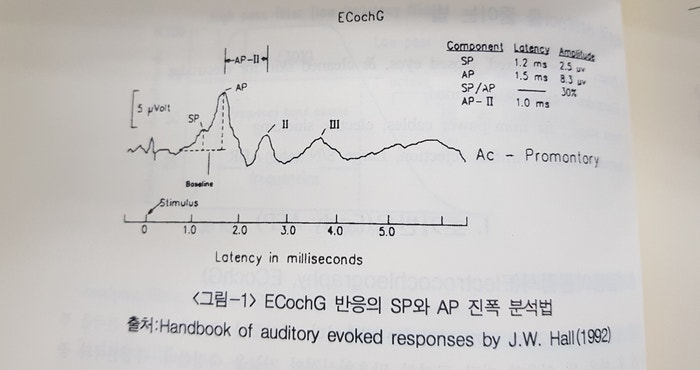전기달팽이관검사 ECochG : 네이버 블로그