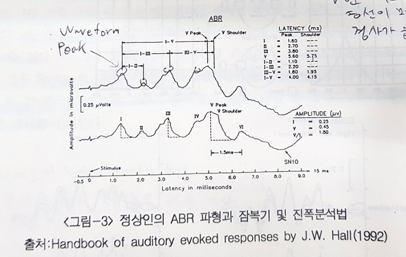 청각장애진단 뇌간유발반응검사 Abr 하는 이유 네이버 블로그