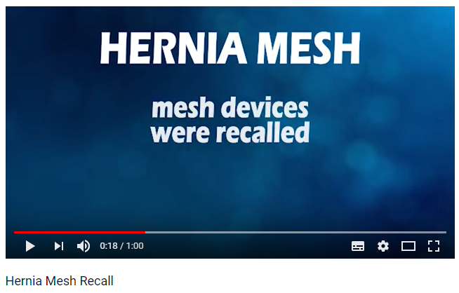 탈장수술 인공망, 얼마나 안전한가? : 네이버 블로그