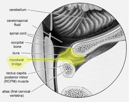 두통 혈압 목뻐근 할때 도수치료가 효과적인이유 myodural bridge : 네이버 블로그