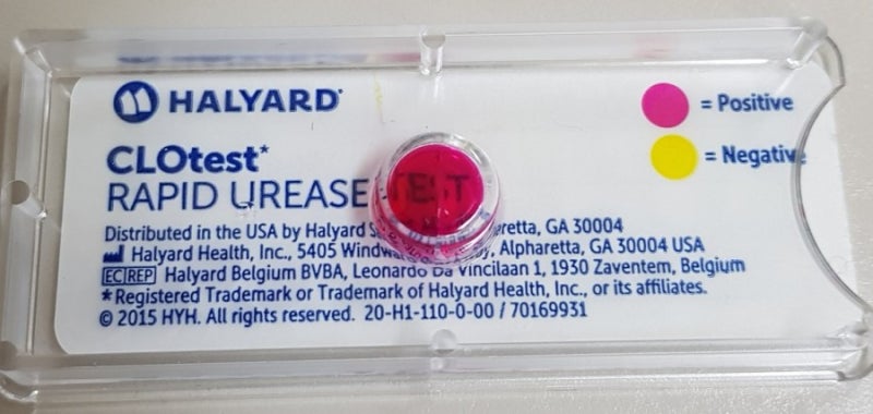 헬리코박터 (Helicobacter Pylori) 균주검사의 급여기준. CLO test : 네이버 블로그