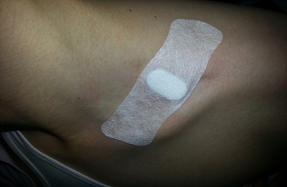 NICHIBAN STEPTY, STEPTY-P (압박지혈밴드) : 네이버 블로그