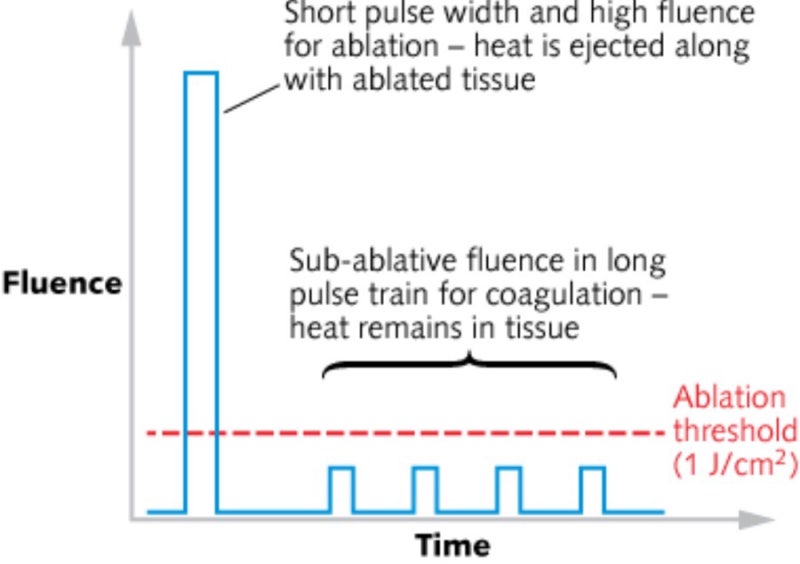 레이저의 세기, 플루언스 뜻, fluence 뜻, laser intensity : 네이버 블로그