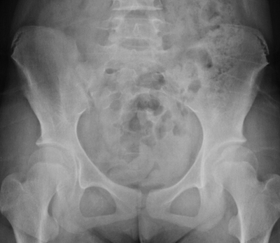 성장판검사방법!성장판확인법!성장판사진! : 네이버 블로그