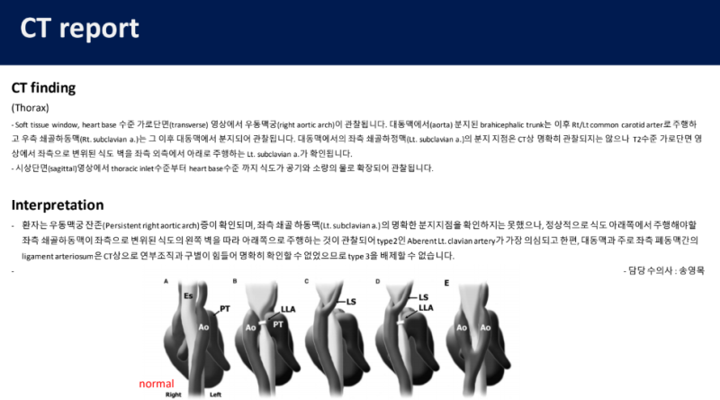 심장혈관기형수술: 강아지 우대동맥궁 잔존증: PRAA: 대구 수술전문동물병원(대구24시동물병원 범어동물의료센터) : 네이버 블로그