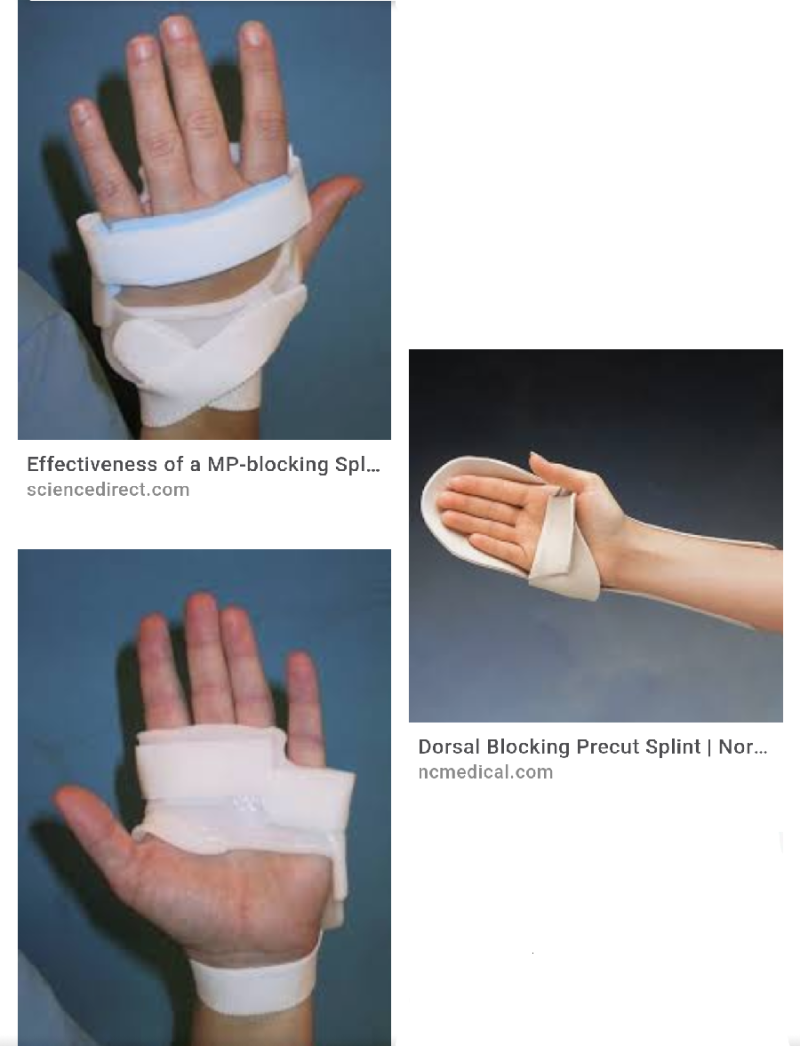 2018.10.30 상지 보조도구/스플린트 (+ 2018.12.02 수정) : 네이버 블로그