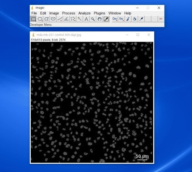 imagej를 이용한 cell counting 방법 : 네이버 블로그