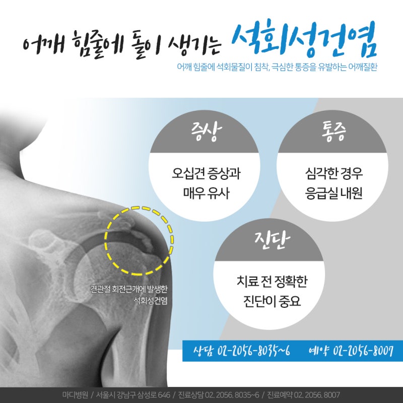 어깨석회성건염 증상과 치료 어깨수술 잘하는 병원 네이버 블로그