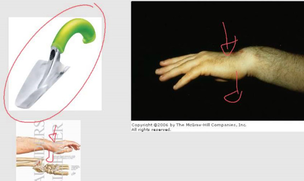 Garden Spade Deformity Picture | Fasci Garden