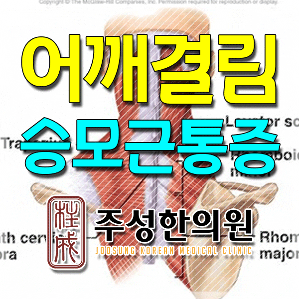 어깨결림 승모근통증 서현역한의원에서 치료하세요 네이버 블로그